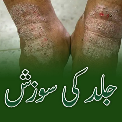 Common Diseases – Uzfan Health Care