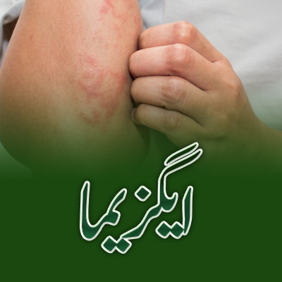 Common Diseases – Uzfan Health Care